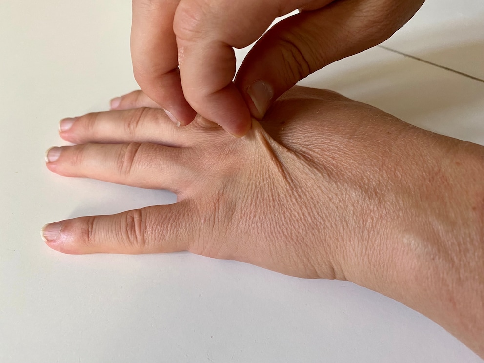 Three-Second Skin Test Reveals If You're Dehydrated, Expert Says