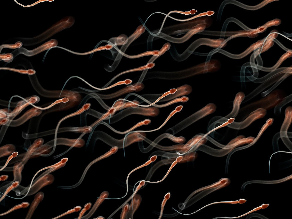 Why Sperm Quality in Men Continues to Decline