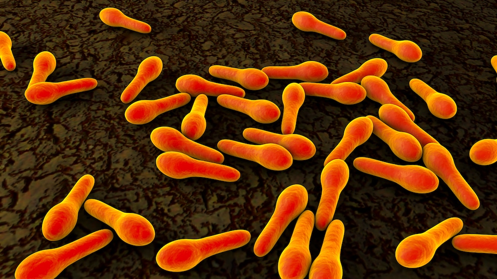 Tetanus: causes, symptoms and treatment - FITBOOK