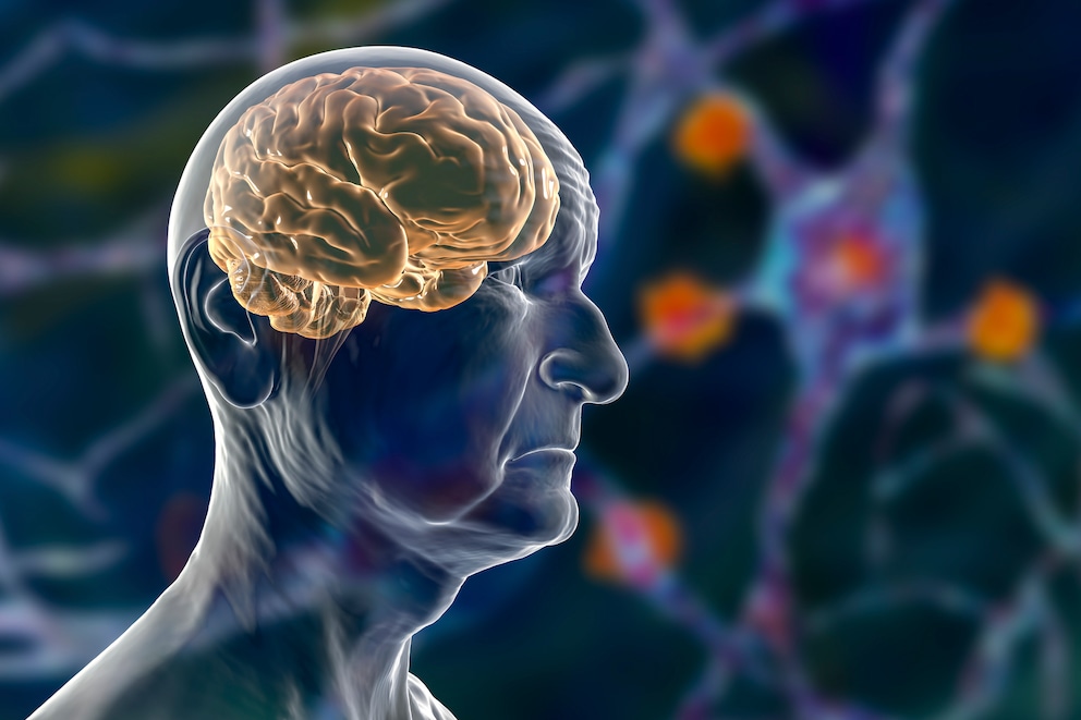 Dementia: When to See a Doctor