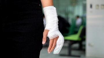 Flying With a Cast: What You Need to Know